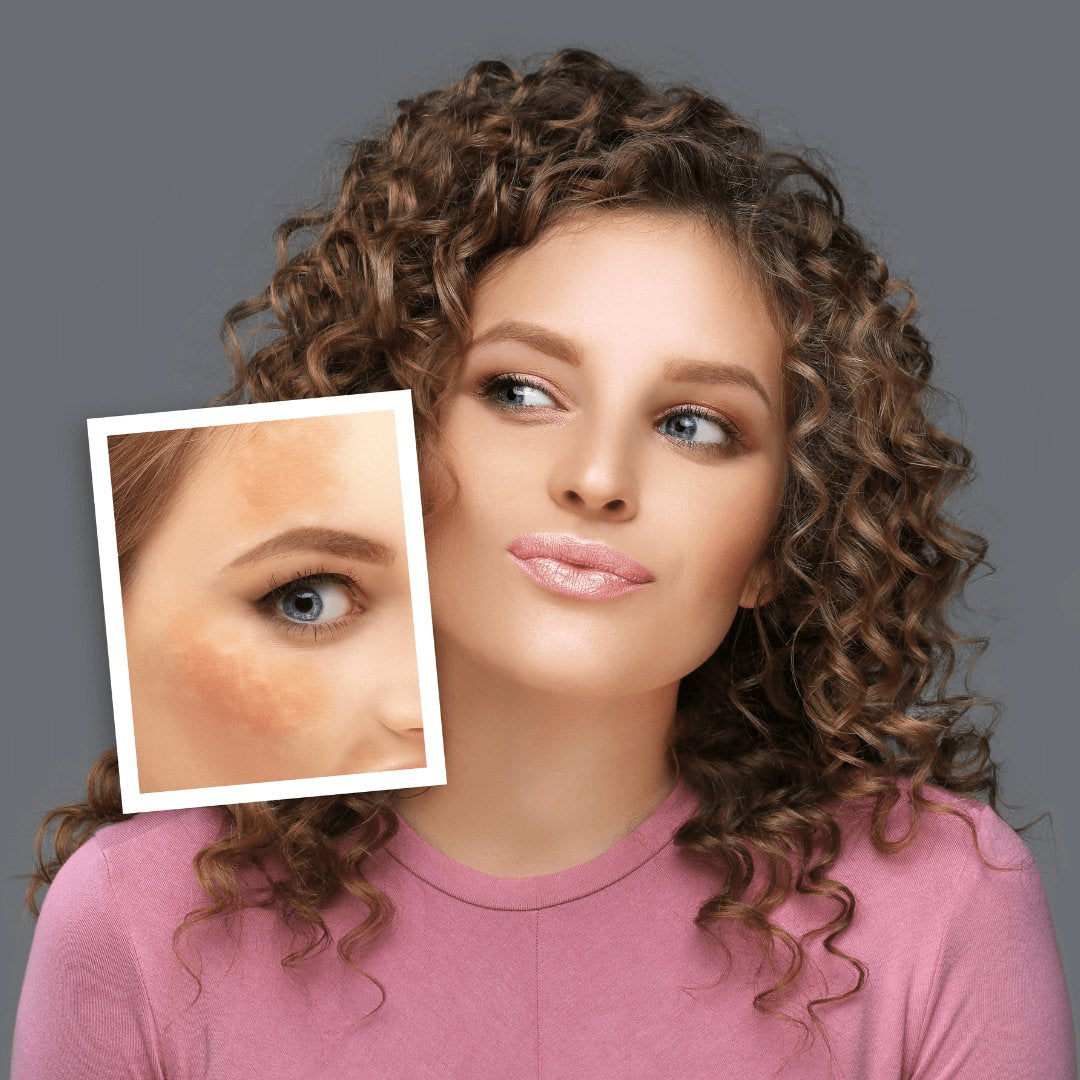 Personalized Skin Treatments Designed Just for You! – Advanced Skin and ...